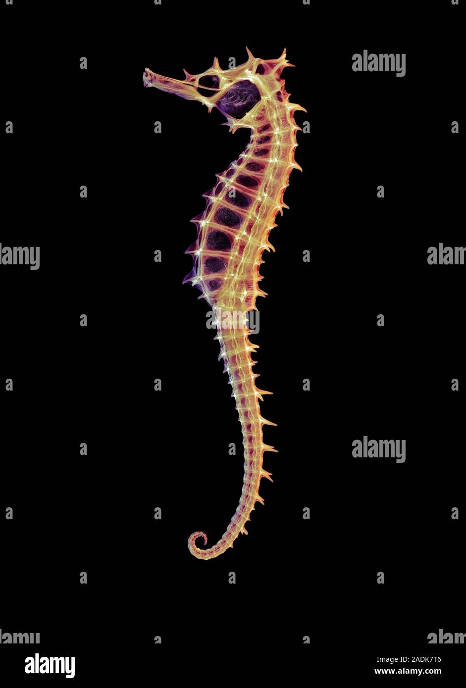 Seahorse skeleton. Coloured x-ray of a seahorse (Hippocampus sp ...
