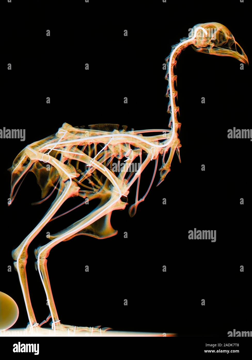 Ostrich skeleton. Coloured x-ray of an ostrich (Struthio camelus). This ...