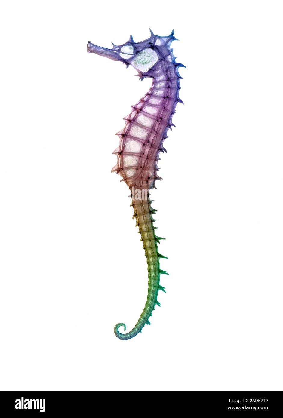 Seahorse skeleton. Coloured x-ray of a seahorse (Hippocampus sp ...