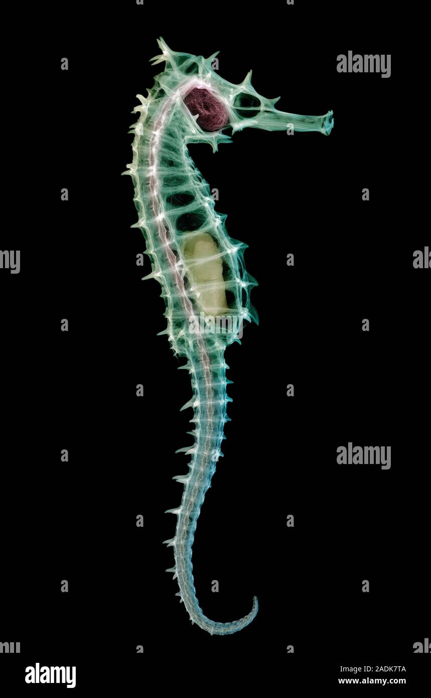 Seahorse skeleton. Coloured x-ray of a seahorse (Hippocampus sp ...
