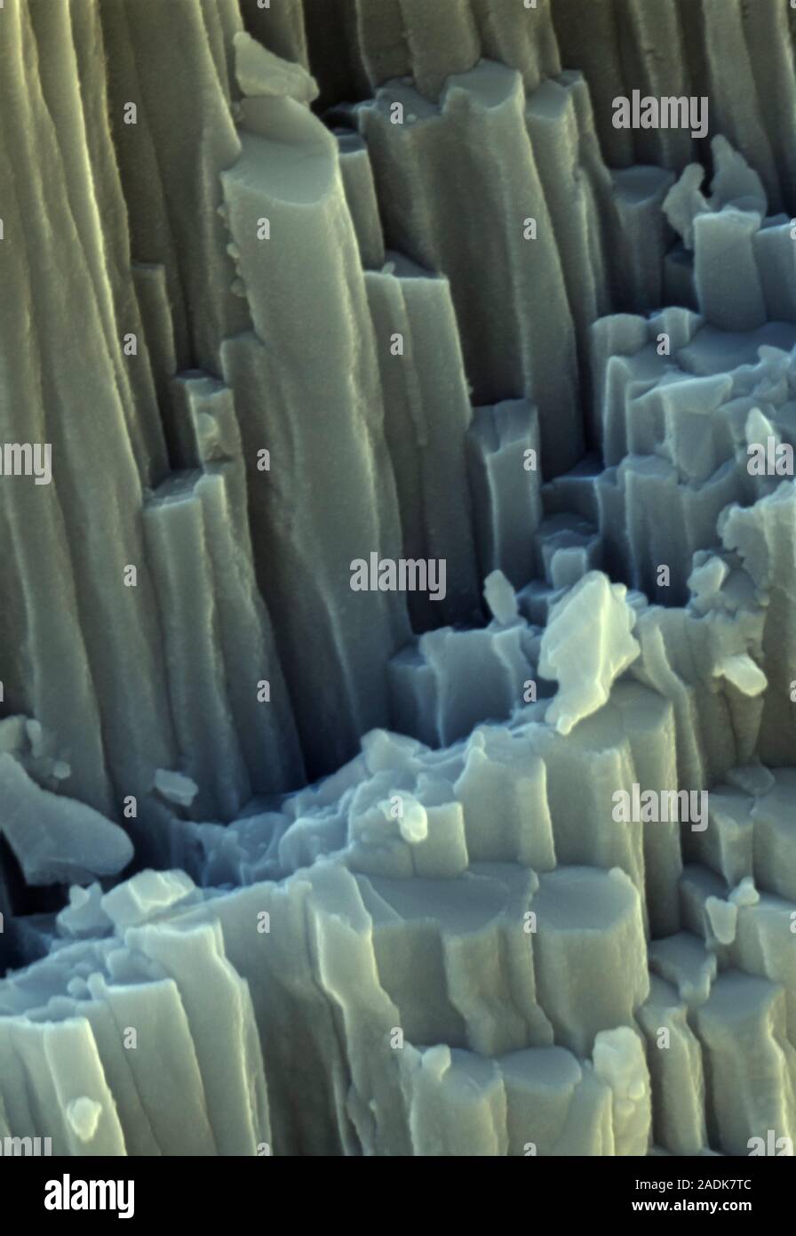 Mollusc shell, coloured scanning electron micrograph (SEM). The shell ...