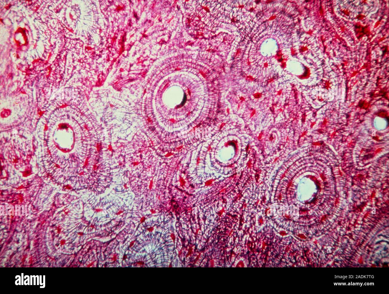 Light micrograph of a cross-section of normal human compact bone tissue ...