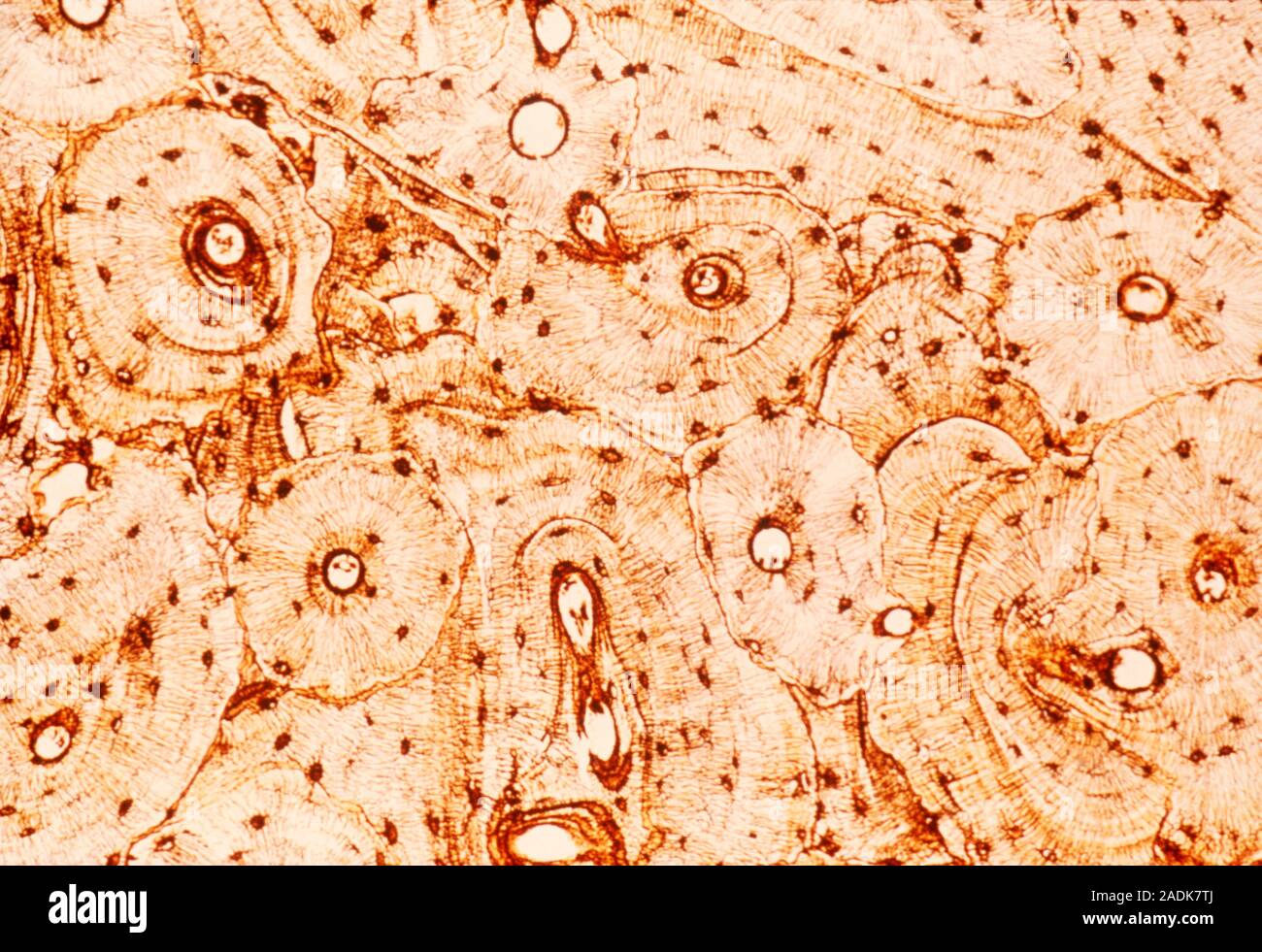 Light micrograph of a cross-section of normal mammalian bone. The rings ...