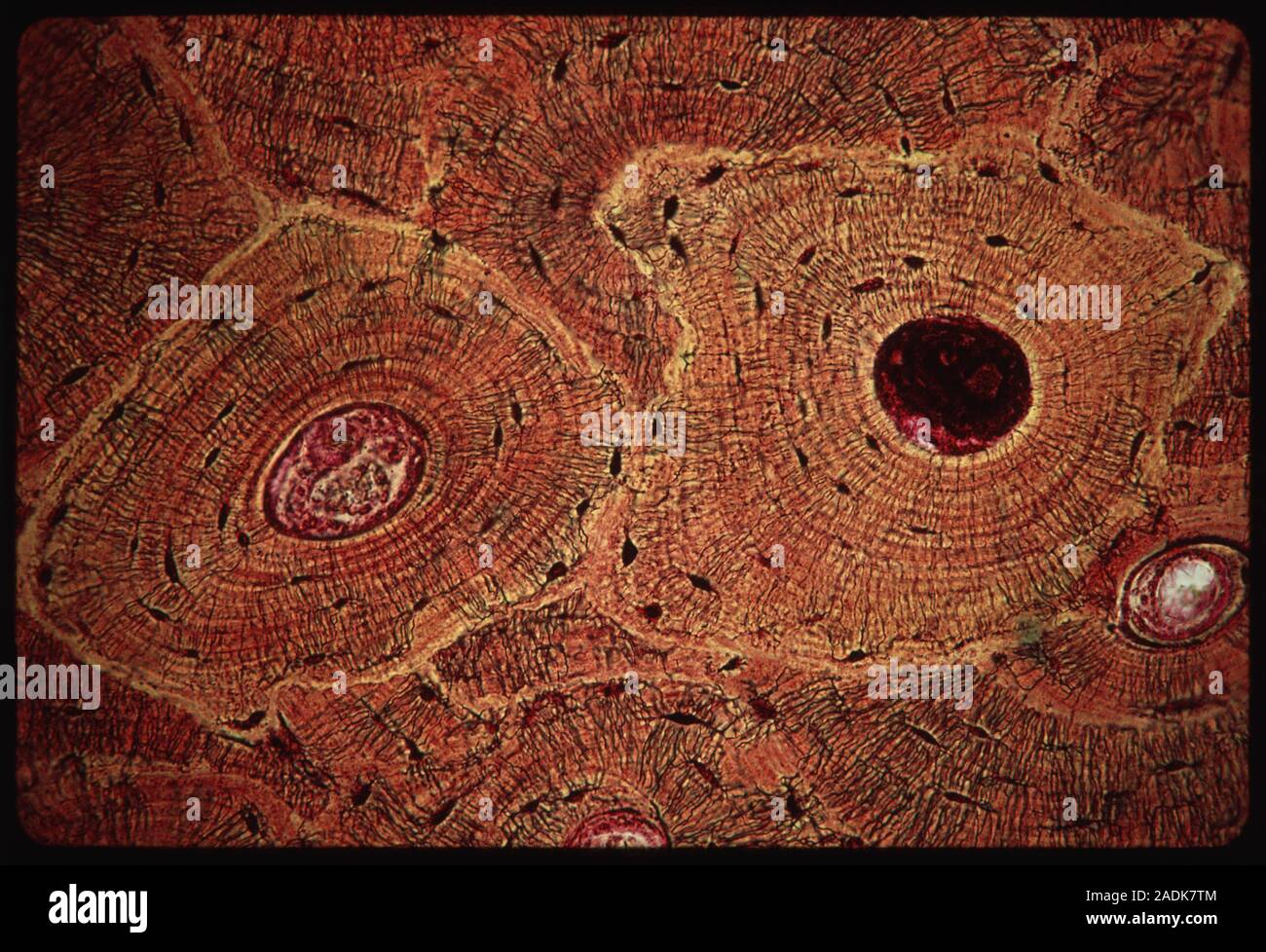 Light micrograph of human compact bone tissue, in cross-section ...