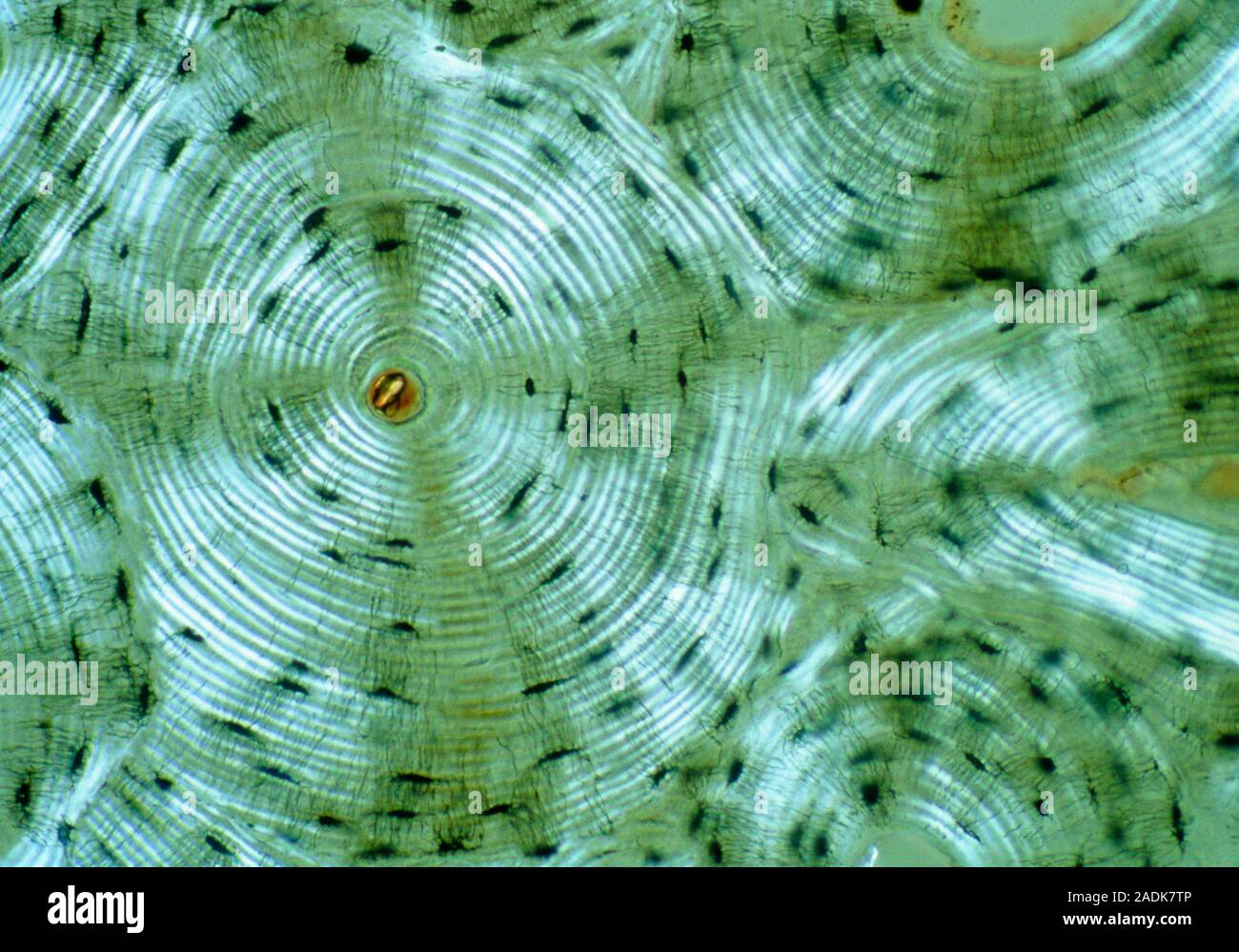 Light micrograph of a thin cross-section of normal human compact bone ...