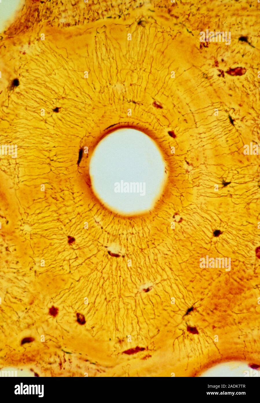 Light micrograph of human compact bone, showing a Haversian system ...