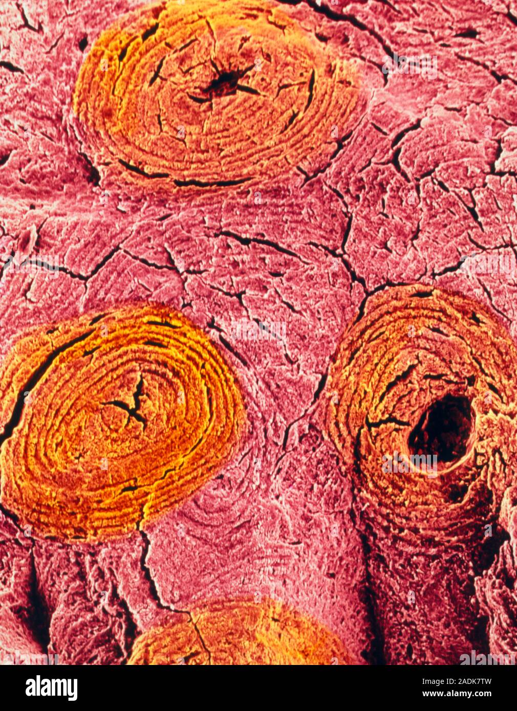 False-colour scanning electron micrograph of a cross-section of normal ...