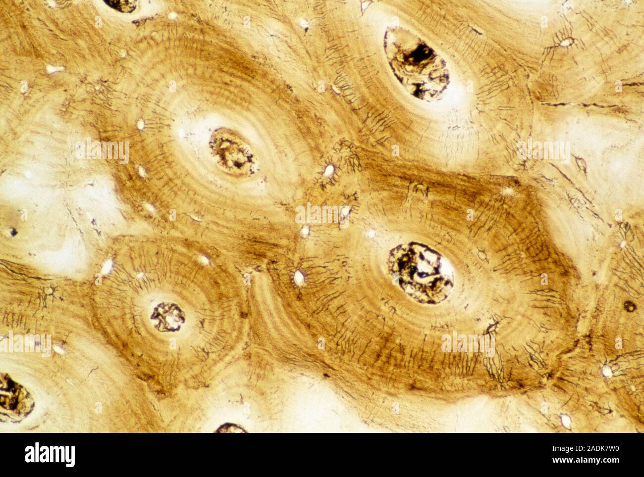 Light micrograph of a cross-section of normal human compact bone tissue ...