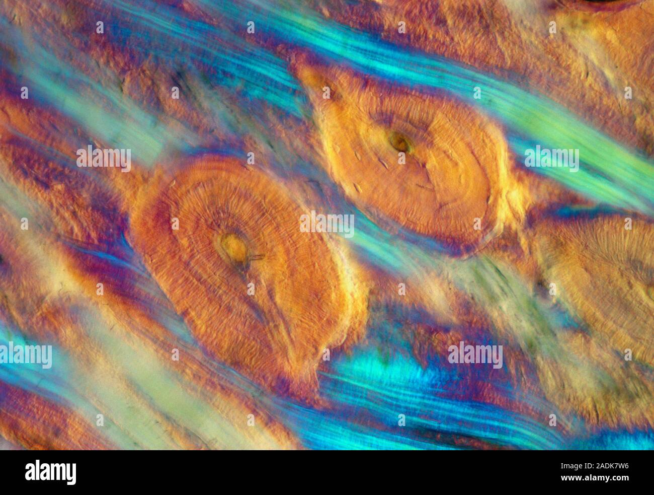 Light micrograph of a transverse section of normal human bone tissue ...