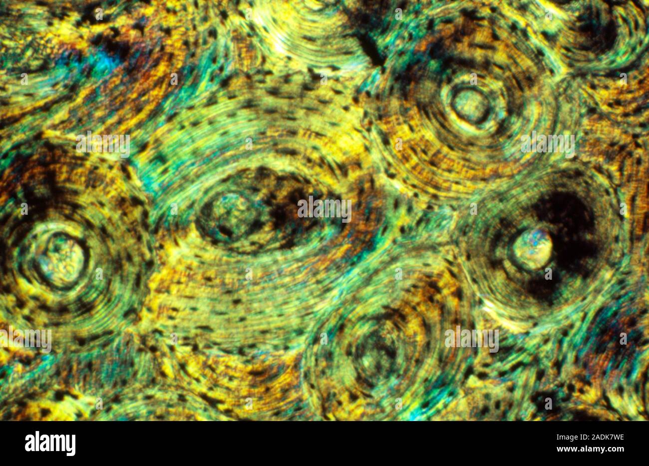 Light micrograph of human compact bone, which comprises the dense walls ...