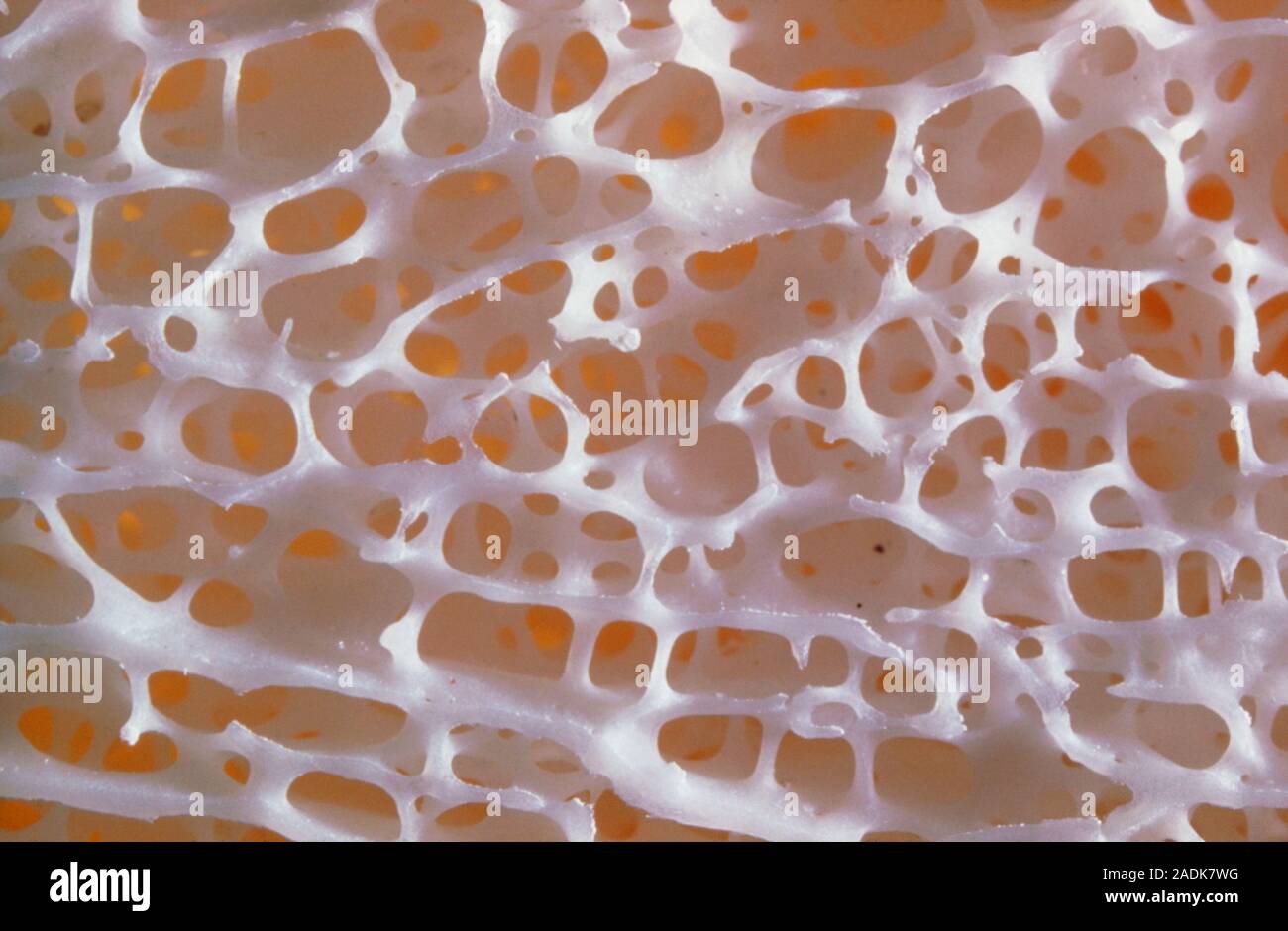 Cancellous bone. Close-up of normal cancellous (spongy) bone from a ...