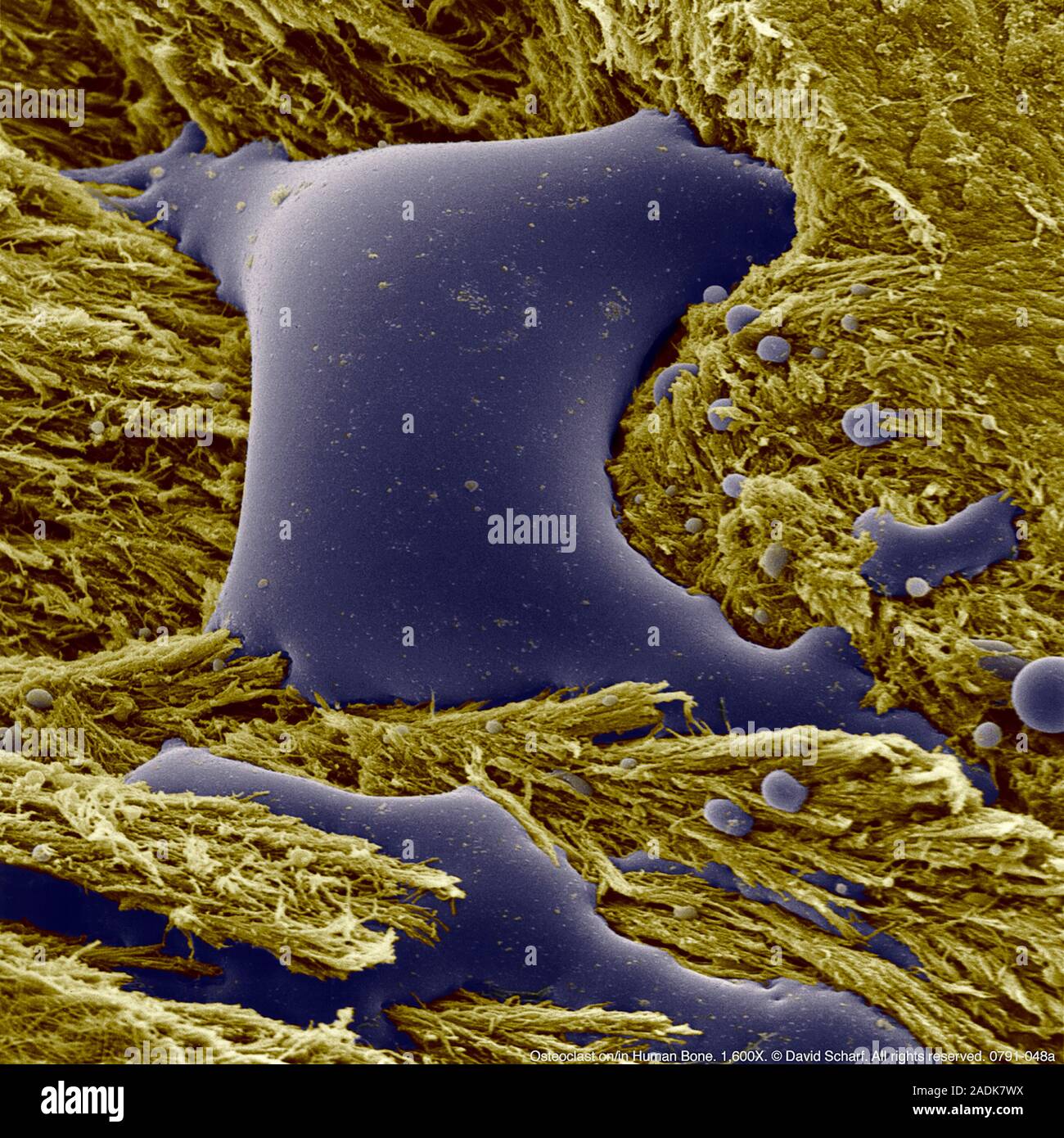 Human osteoclasts. Coloured scanning electron micrograph (SEM) of a ...