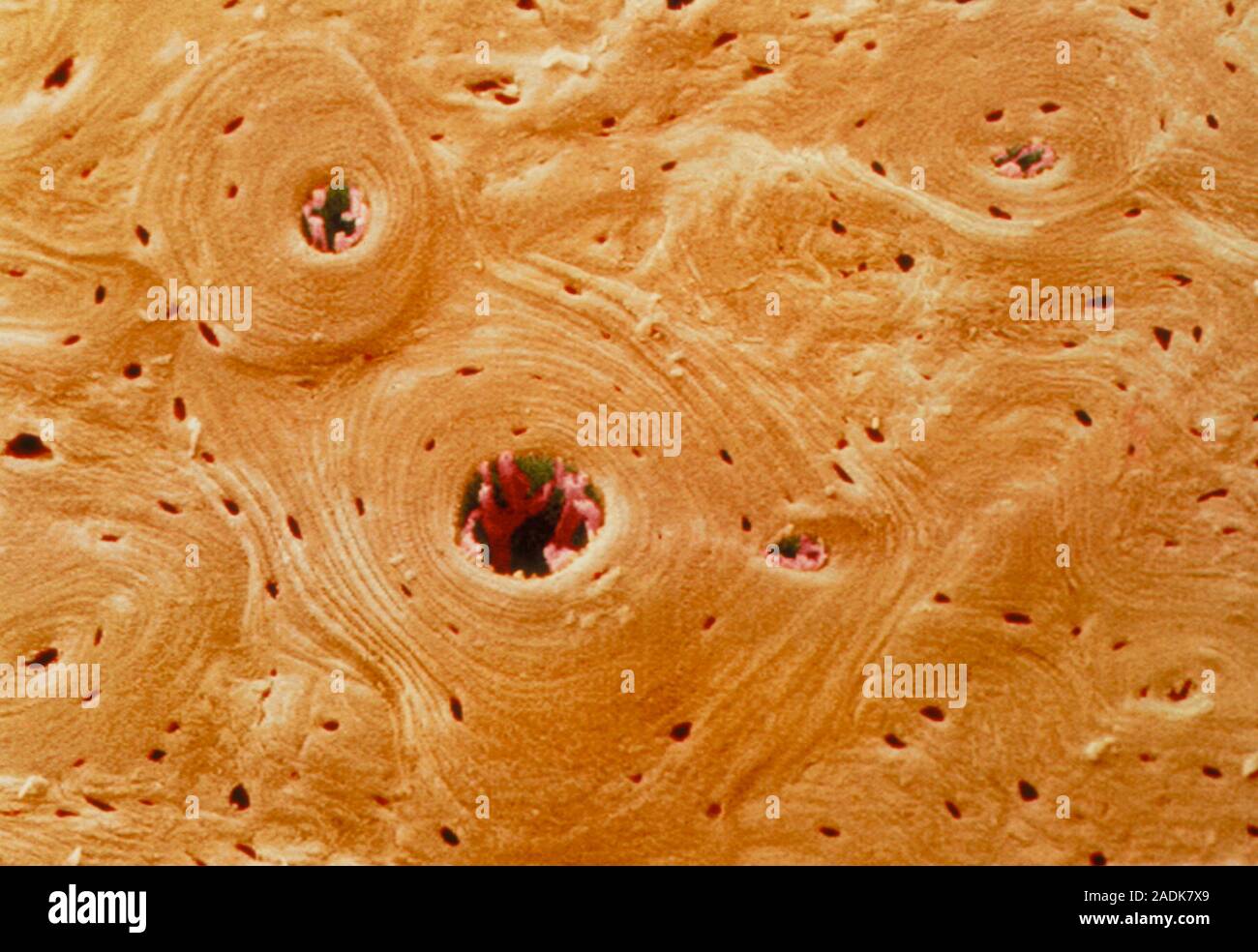 Compact bone. Coloured scanning electron micrograph (SEM) of a ...