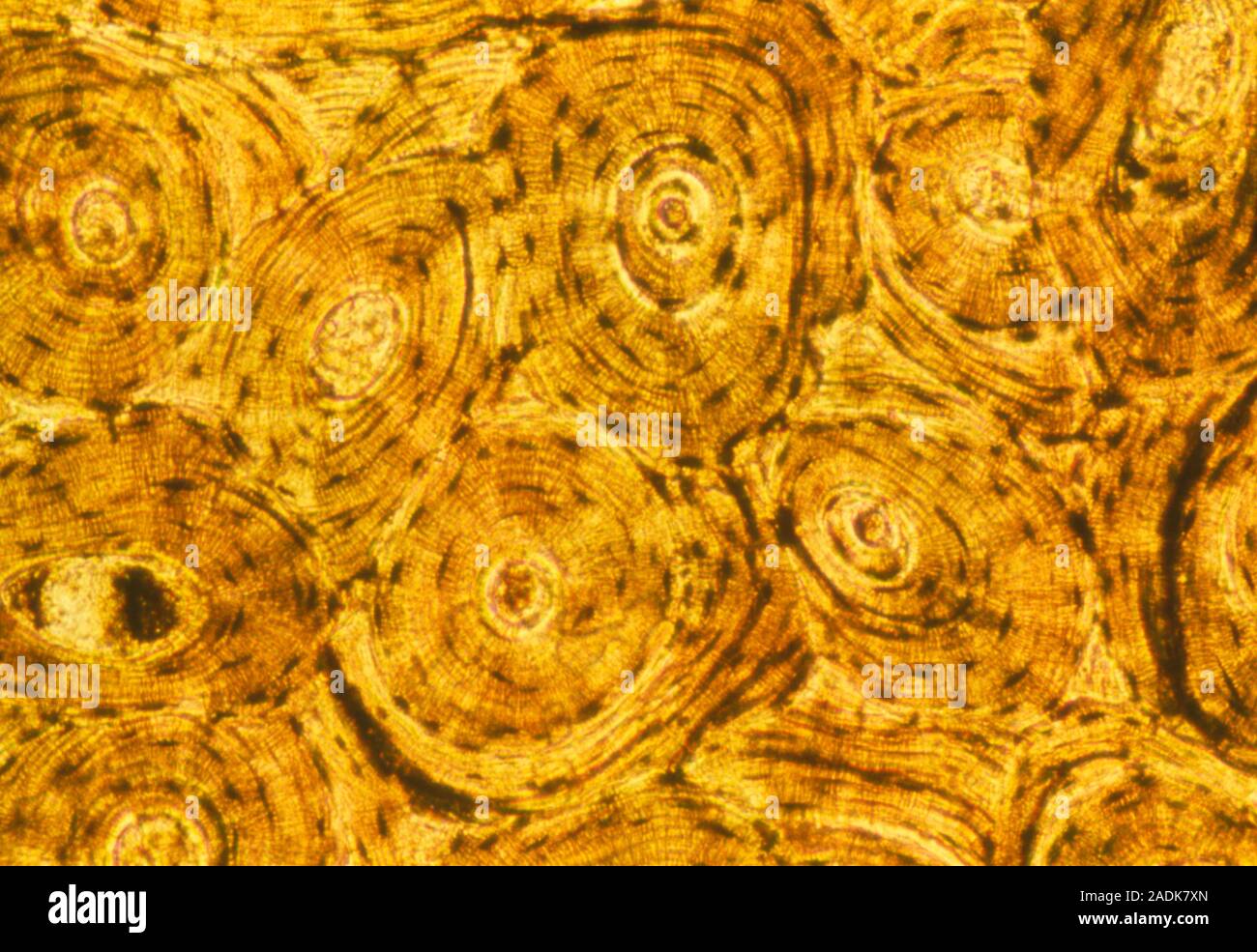 Compact bone. Light micrograph of a transverse section through a ...
