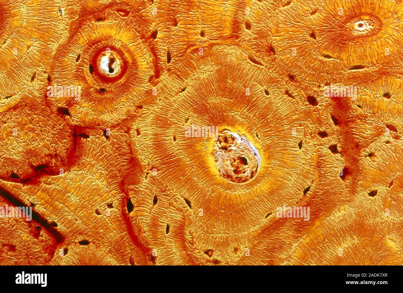 Compact bone. Light micrograph of a transverse section through human ...