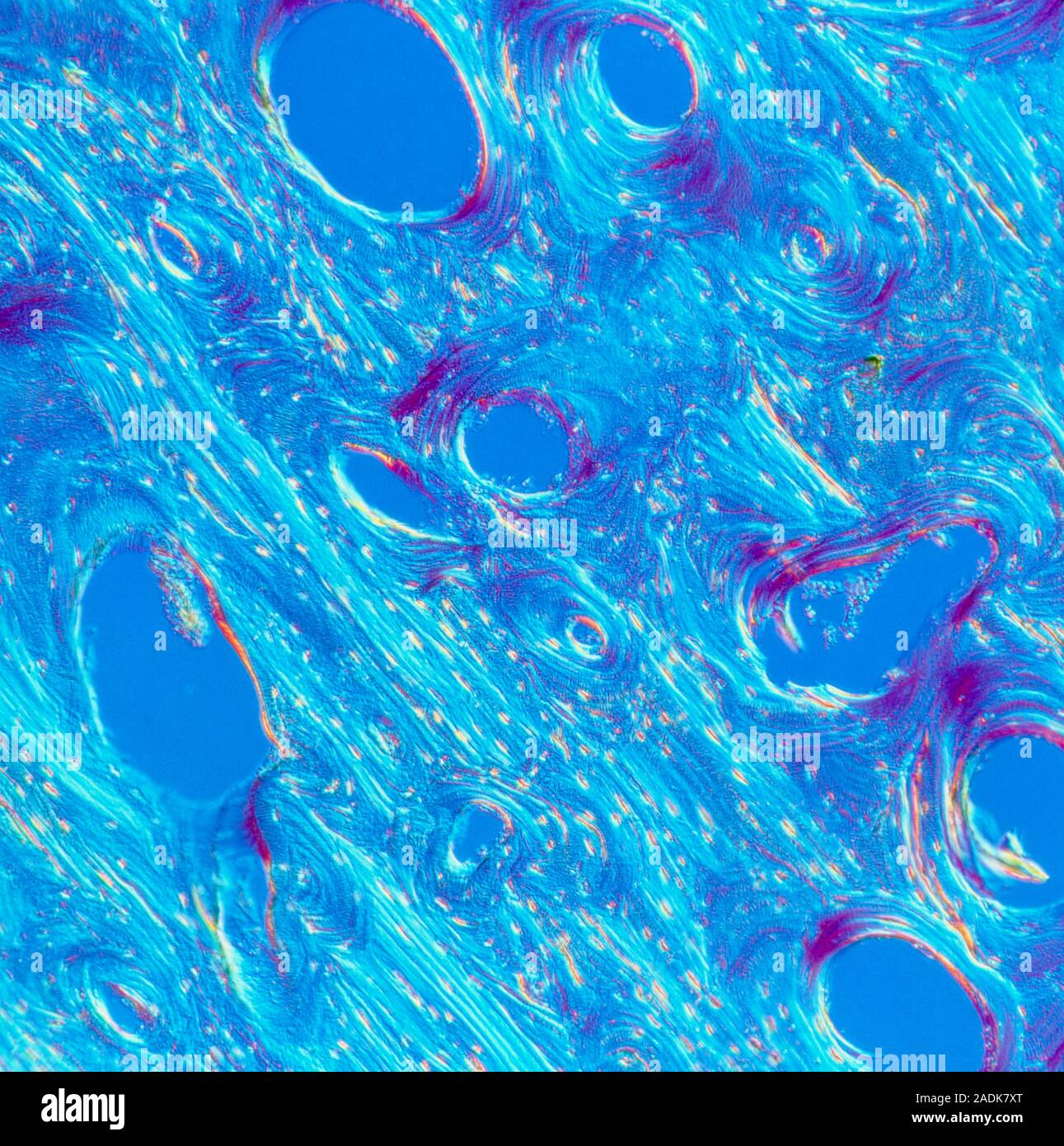 Compact bone. Light micrograph of a section through compact bone from a ...