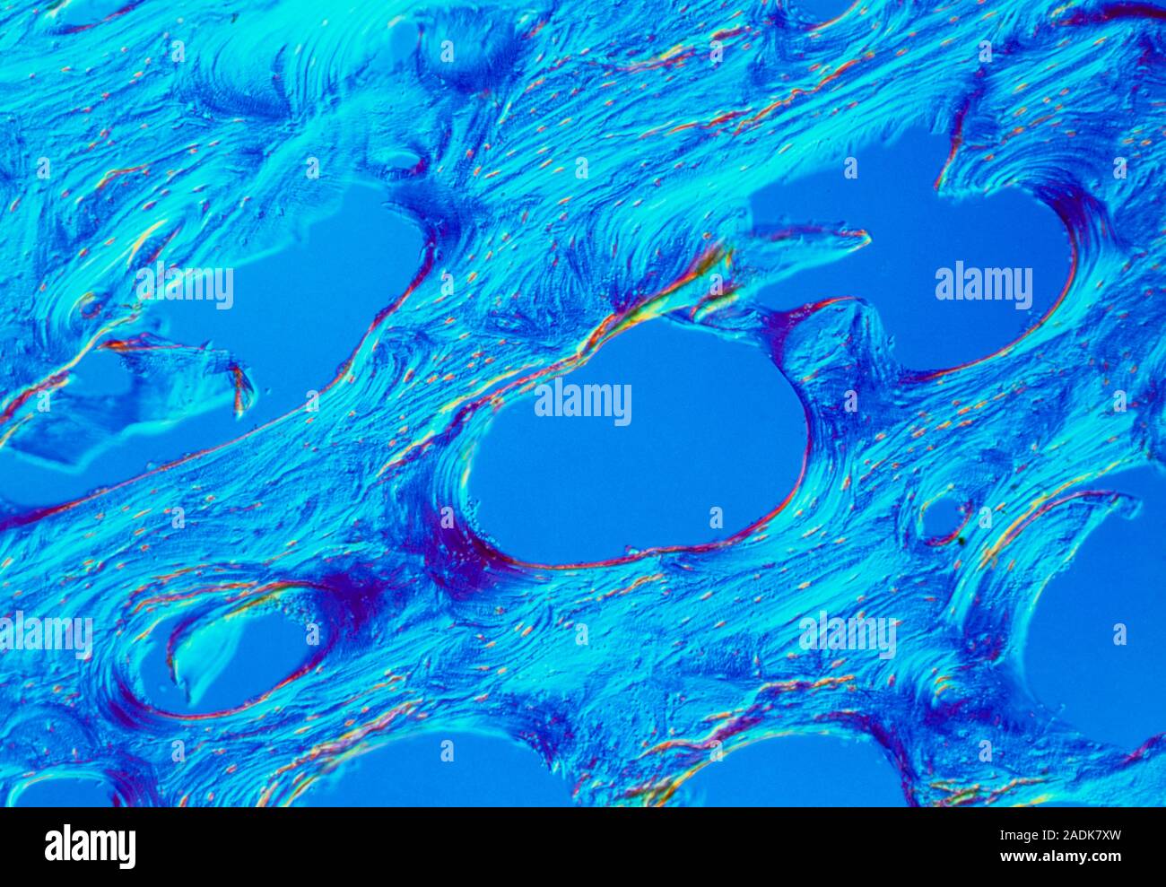 Compact bone. Light micrograph of a section through compact bone from a ...