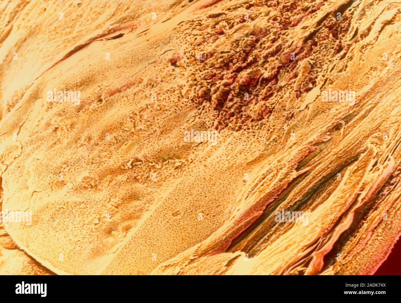 Foetal bone formation. Coloured scanning electron micrograph (SEM) of a ...