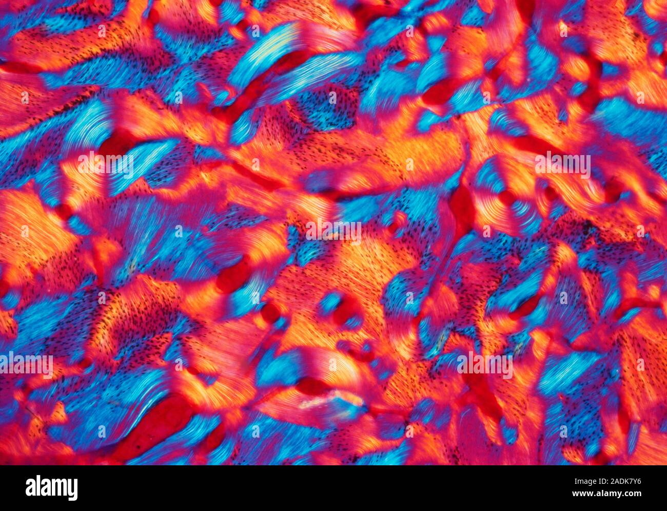 Compact bone. Polarized light micrograph (PLM) of a section through ...