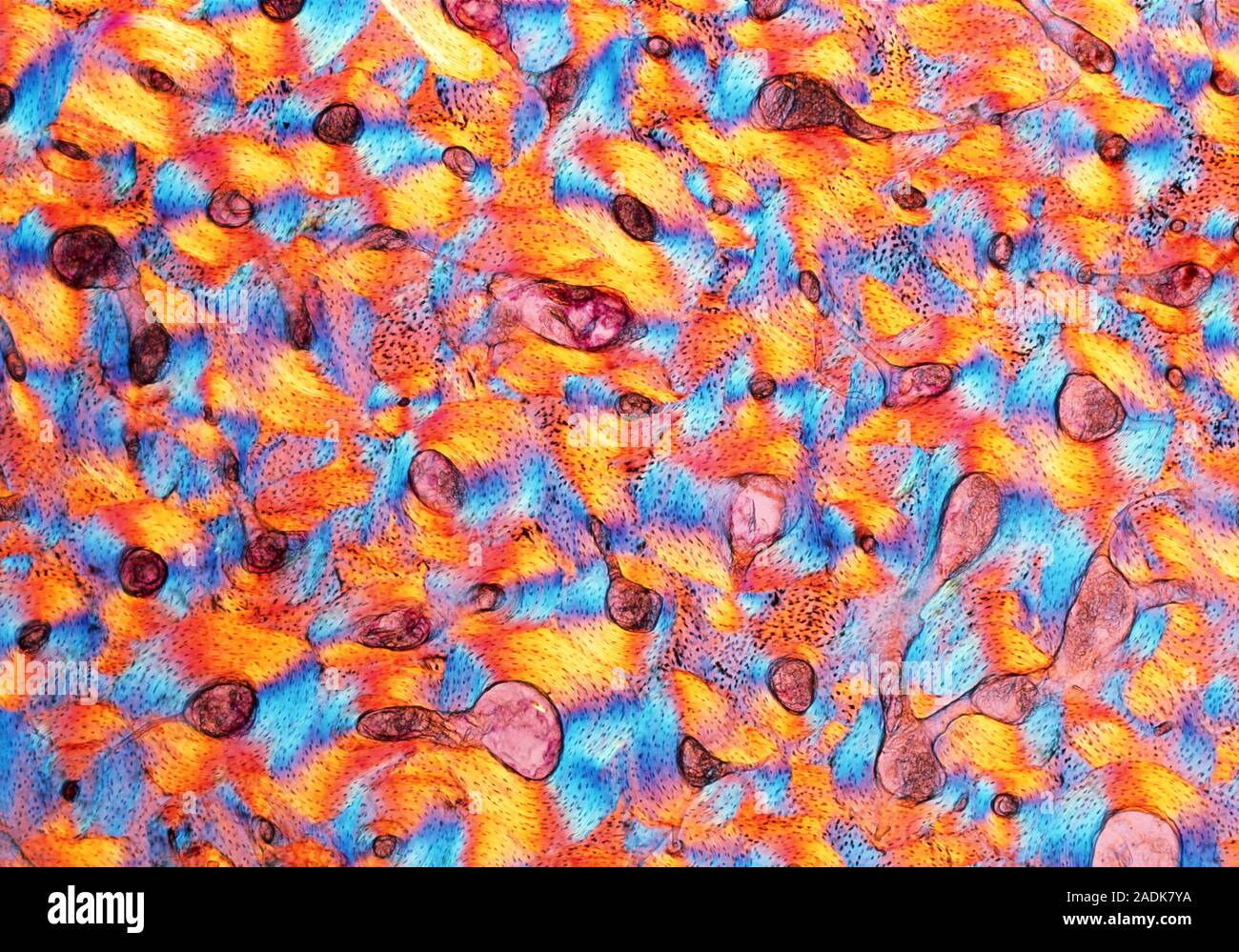 Compact bone. Polarized light micrograph (PLM) of a section through ...