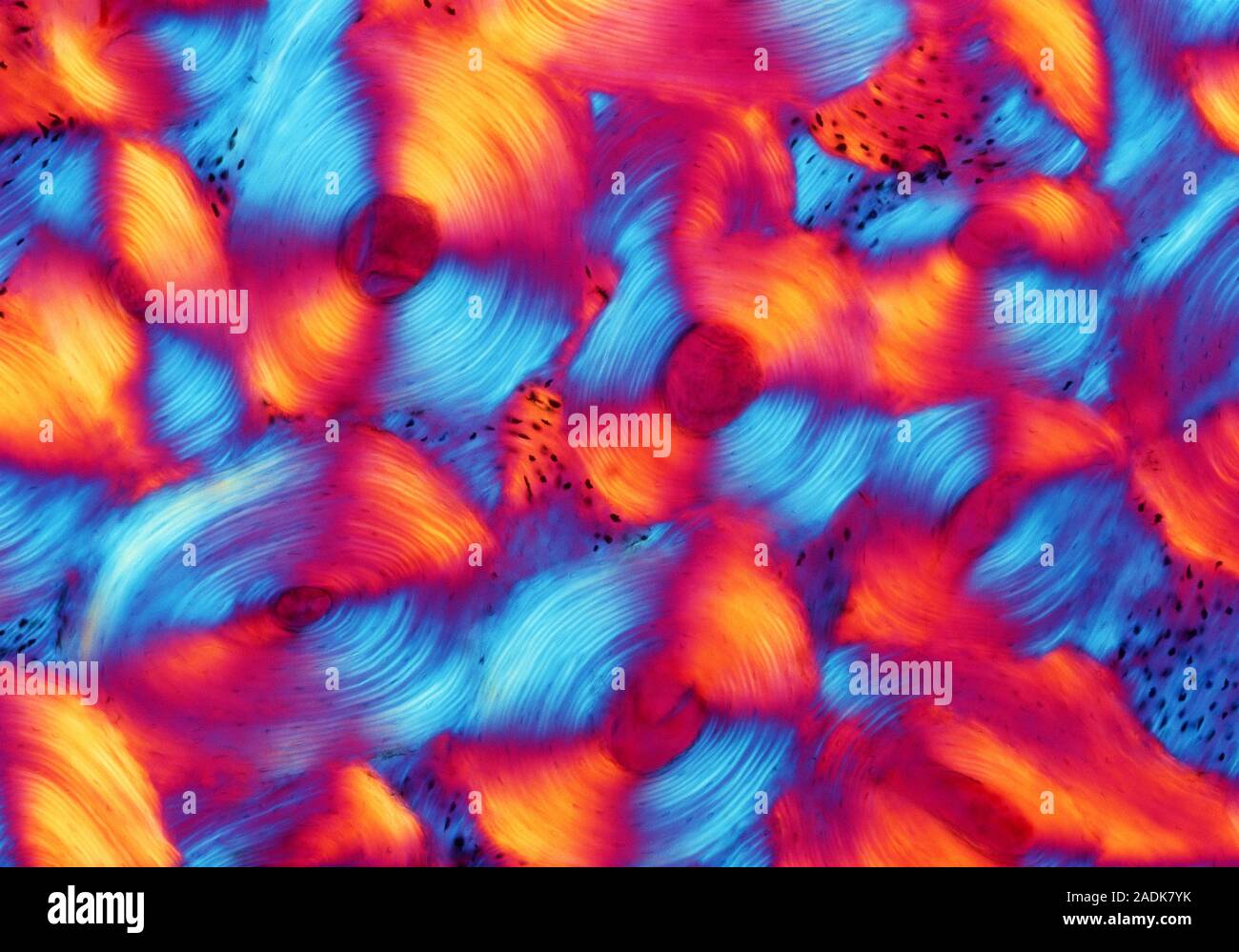 Compact bone. Polarized light micrograph (PLM) of a section through ...