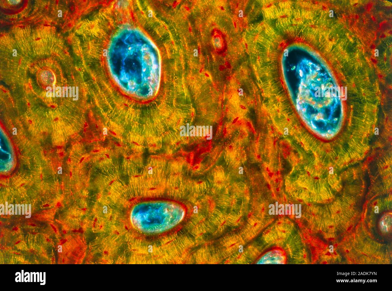 Compact bone. Light micrograph of a section through human compact bone ...