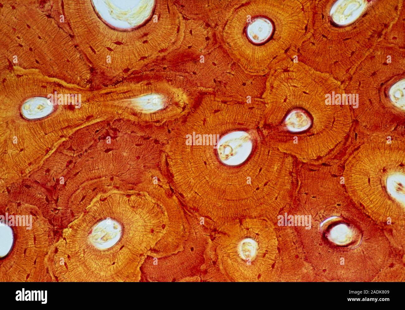 Compact bone. Light micrograph of a section through human compact bone ...