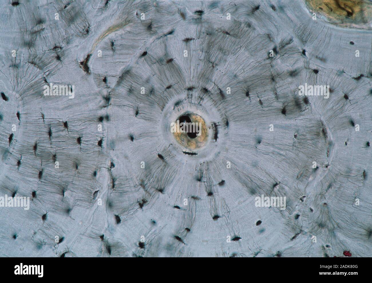 Compact bone. Light micrograph of a section through human compact bone ...