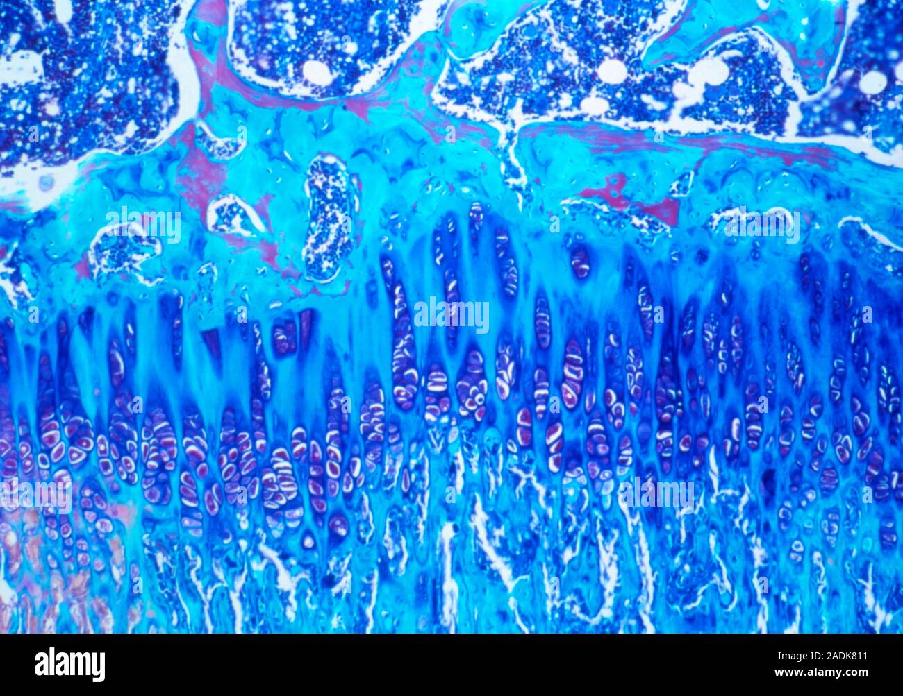 Bone formation. Light micrograph showing bone growth occurring along an ...