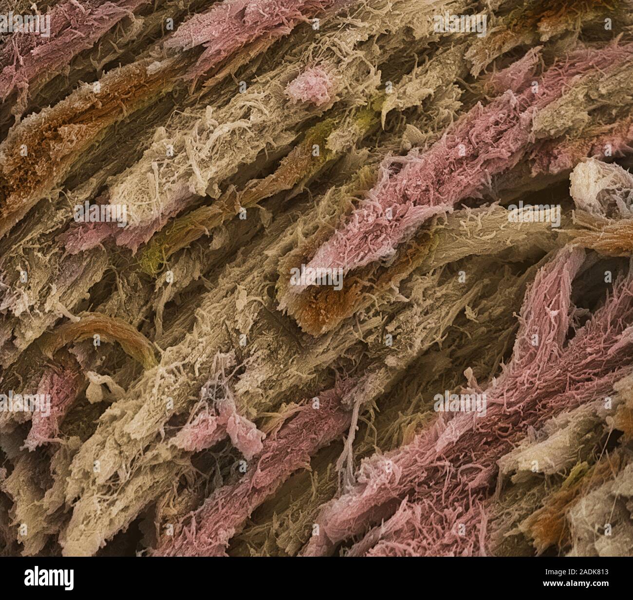 Spongy bone. Coloured scanning electron micrograph (SEM) of freeze ...