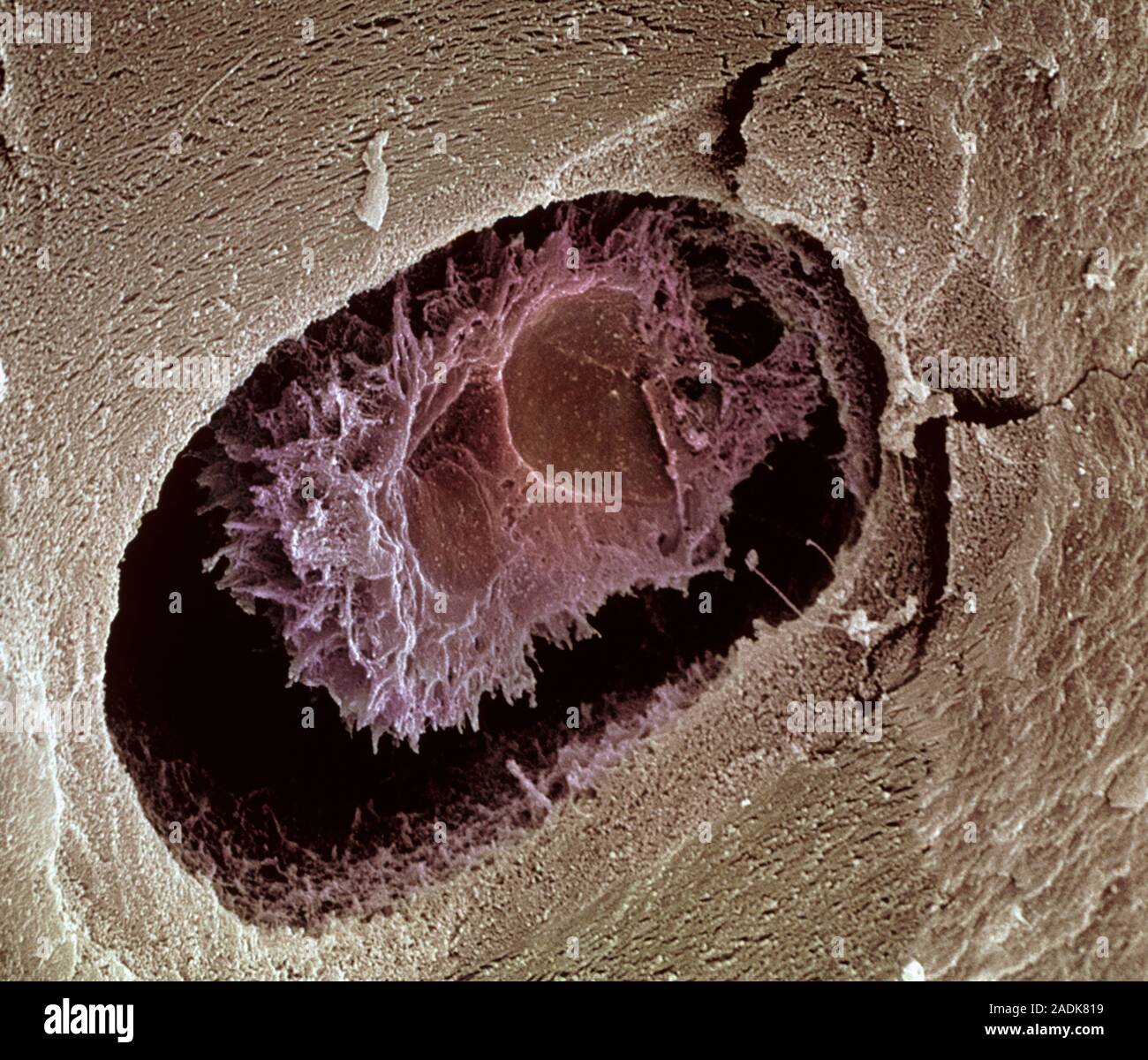Osteocyte. Coloured scanning electron micrograph (SEM) of a freeze ...