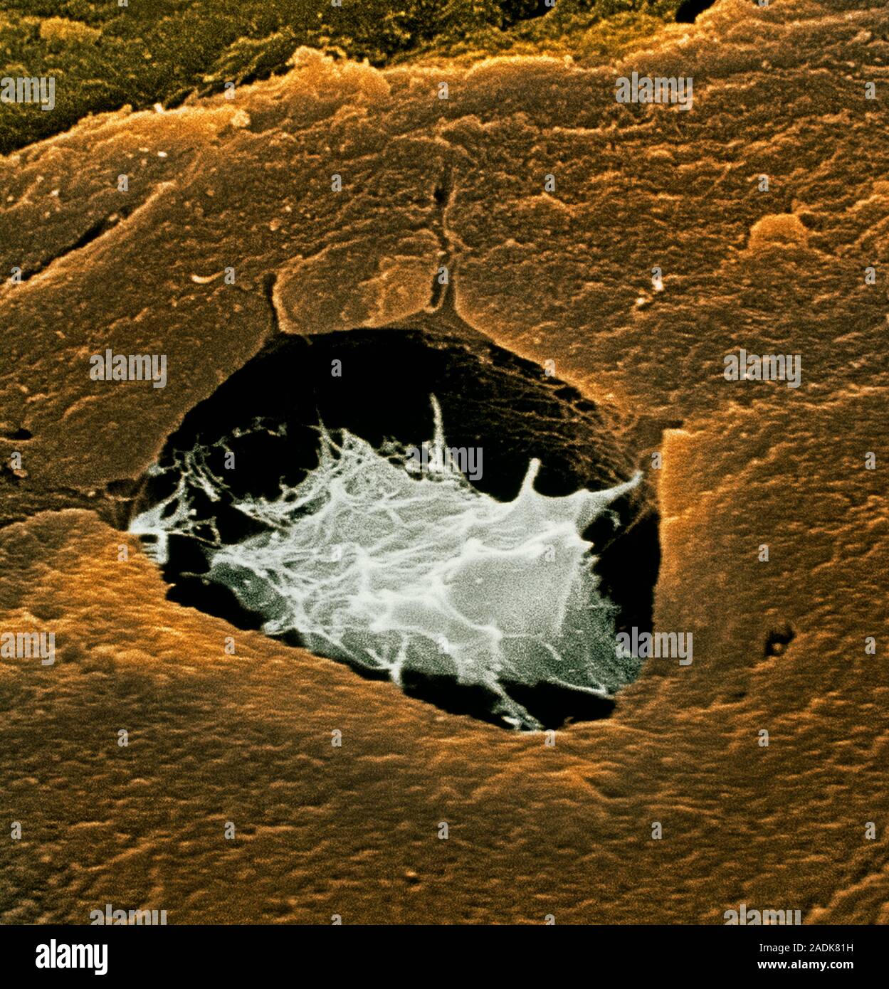 Bone cell. Coloured scanning electron micrograph (SEM) of a freeze ...