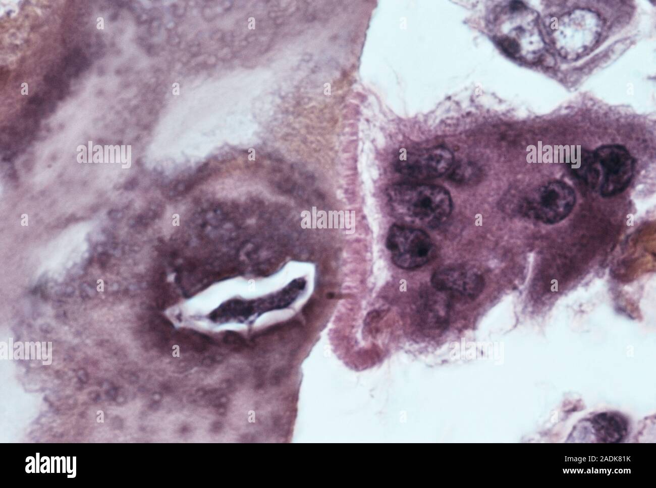Bone absorption. Light micrograph of a section through osteoclasts in ...