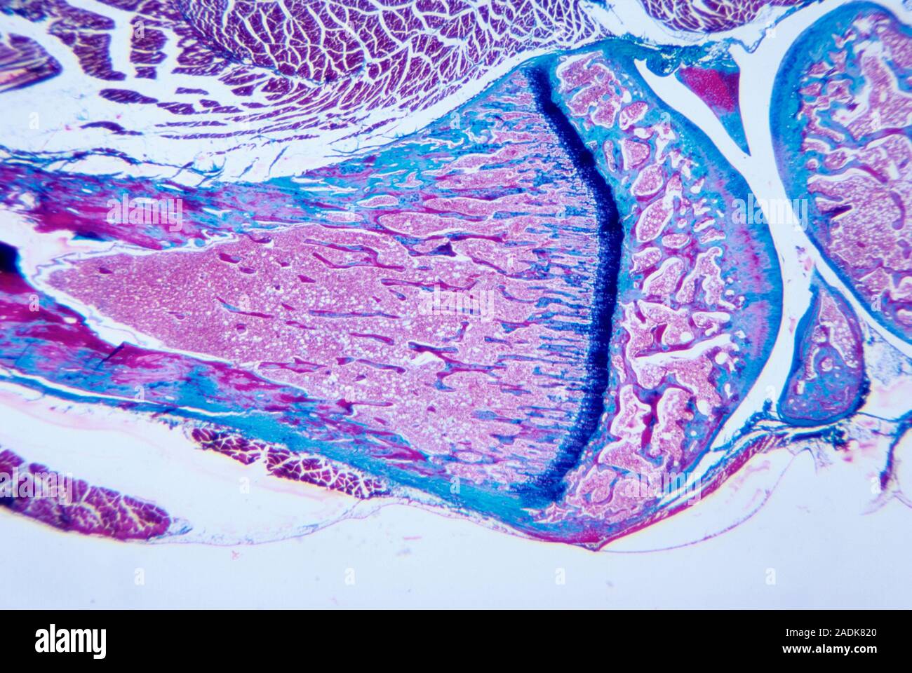 Growing bone. Light micrograph of the growing end of a long bone. The ...