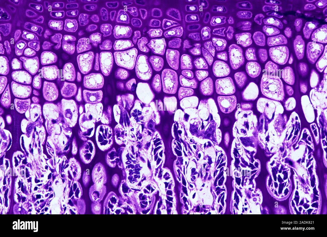 Bone growth. Light micrograph of actively growing cells in the growth ...