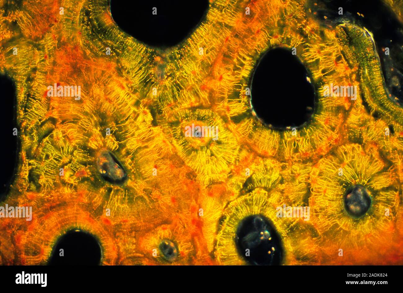 Compact bone. Light micrograph of a section through a mature human bone ...