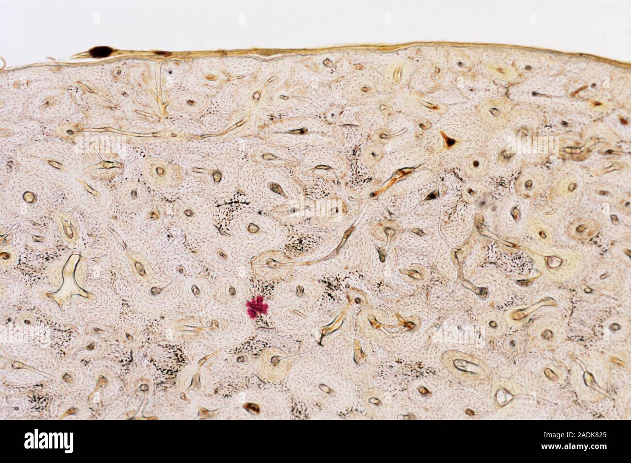 Compact bone. Light micrograph of a section through compact bone in the ...