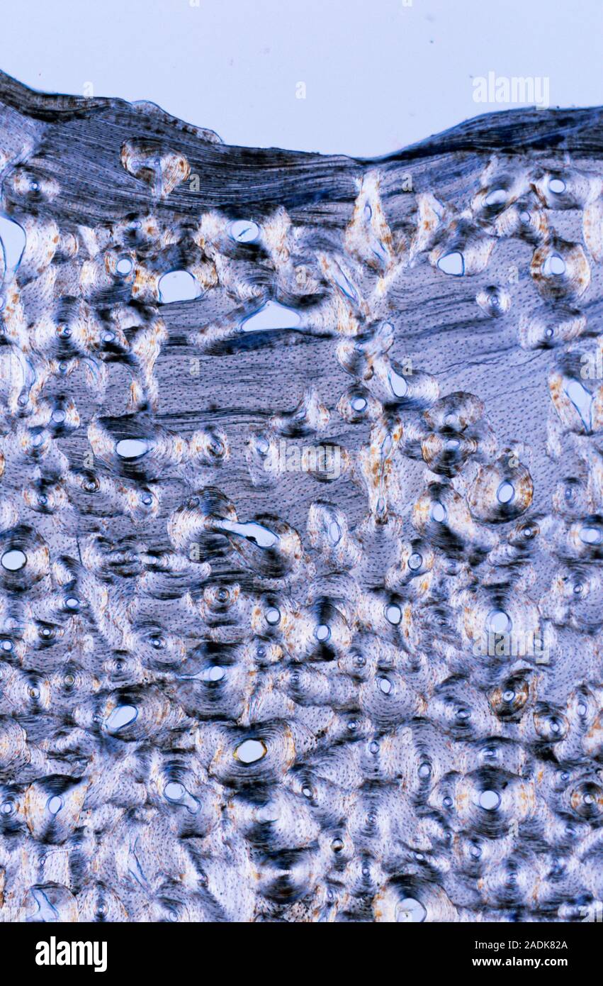 Bone. Polarised light micrograph of a section through the neurovascular ...