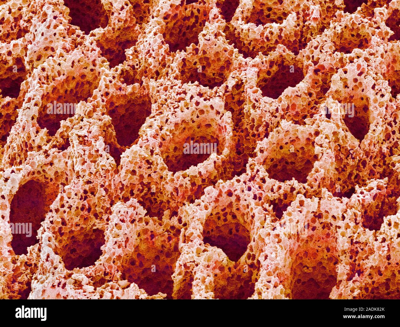 Bone tissue. Coloured scanning electron micrograph (SEM) of cancellous ...