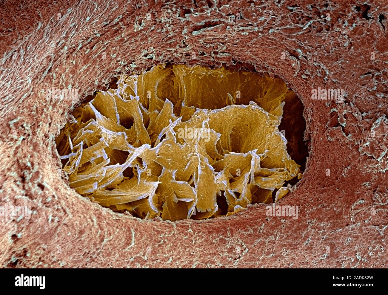 Bone lacuna. Coloured scanning electron micrograph (SEM) of a lacuna ...