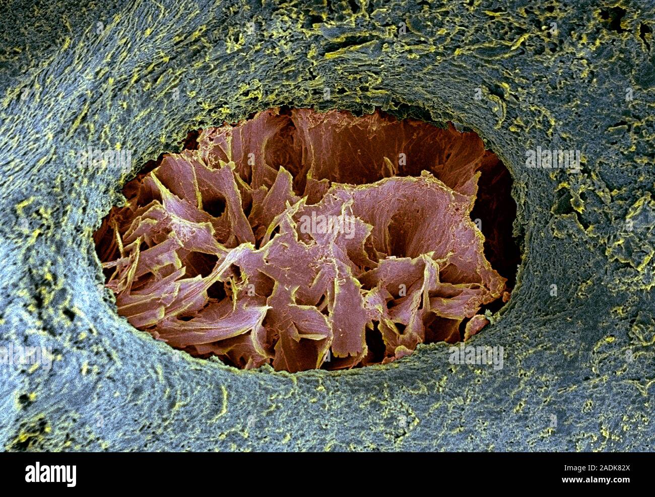 Bone lacuna. Coloured scanning electron micrograph (SEM) of a lacuna ...