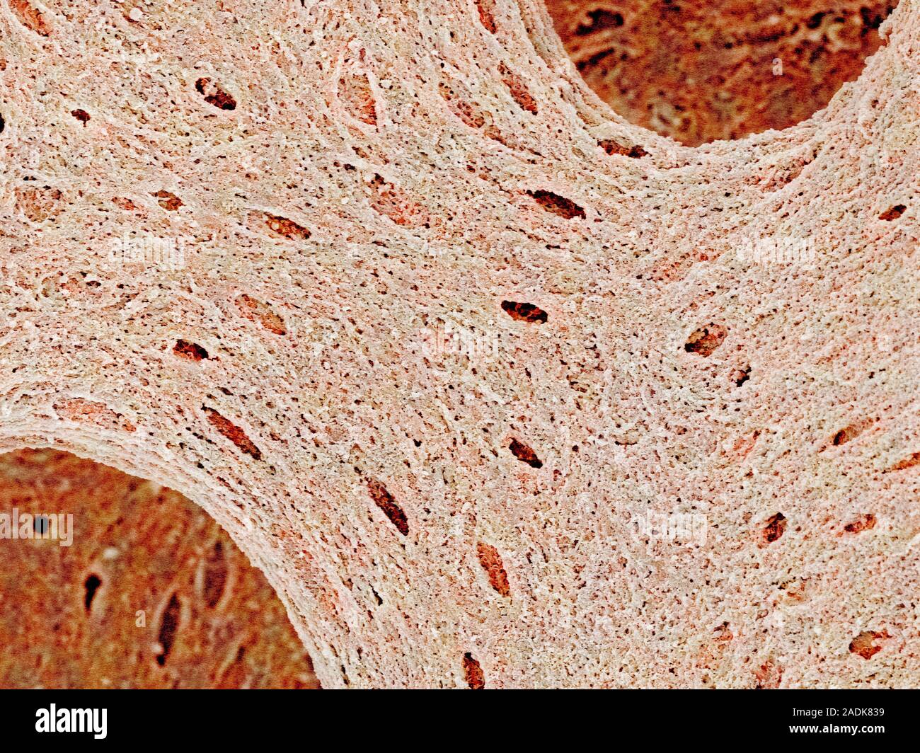 Spongy bone. Coloured scanning electron micrograph (SEM) of a close-up ...