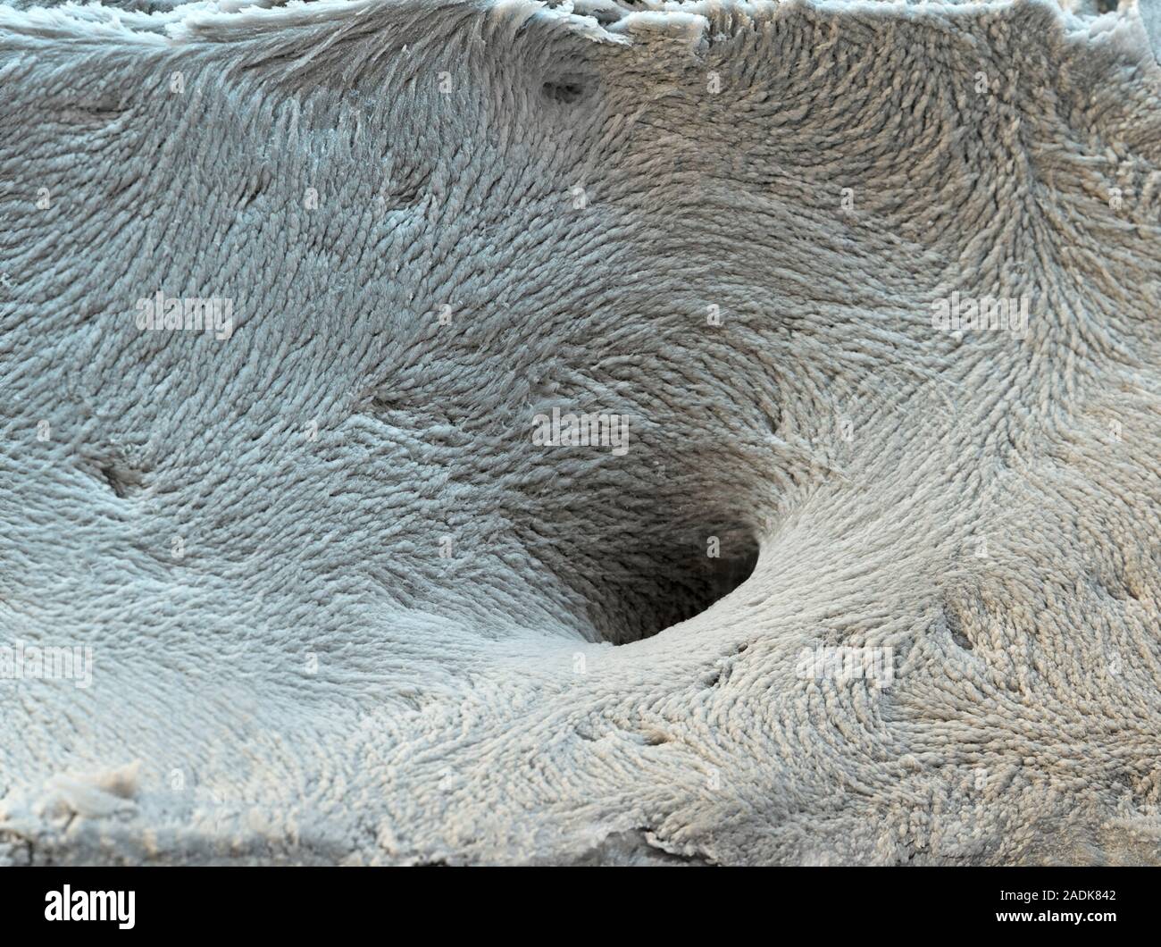 Bone surface. Coloured scanning electron micrograph (SEM) of the ...