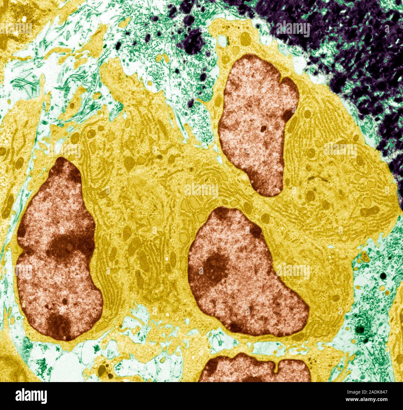 Osteoblasts. Coloured transmission electron micrograph of osteoblasts ...