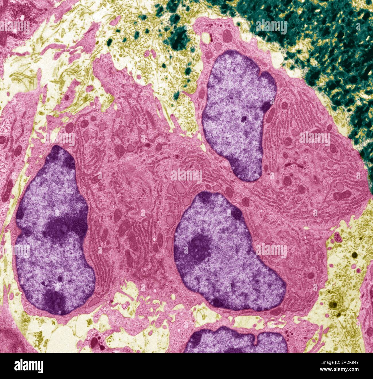 Osteoblasts. Coloured transmission electron micrograph of osteoblasts ...