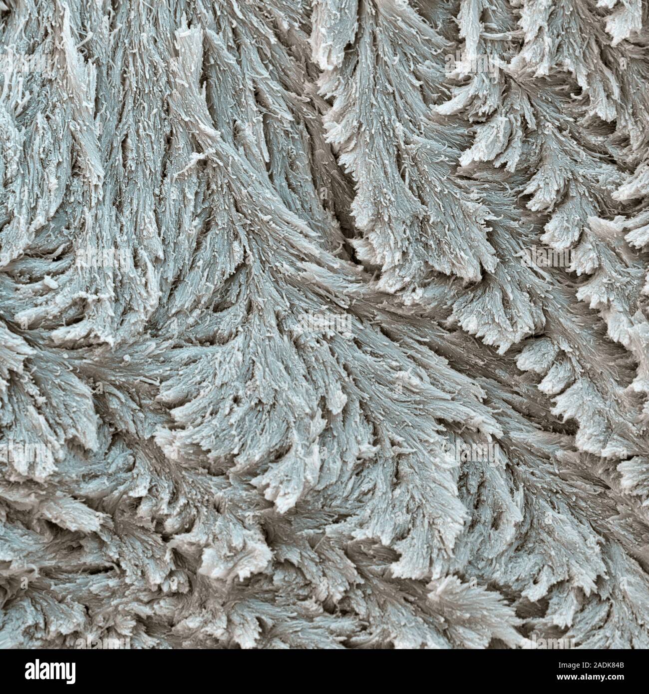 Fractured bone surface. Coloured scanning electron micrograph (SEM) of ...