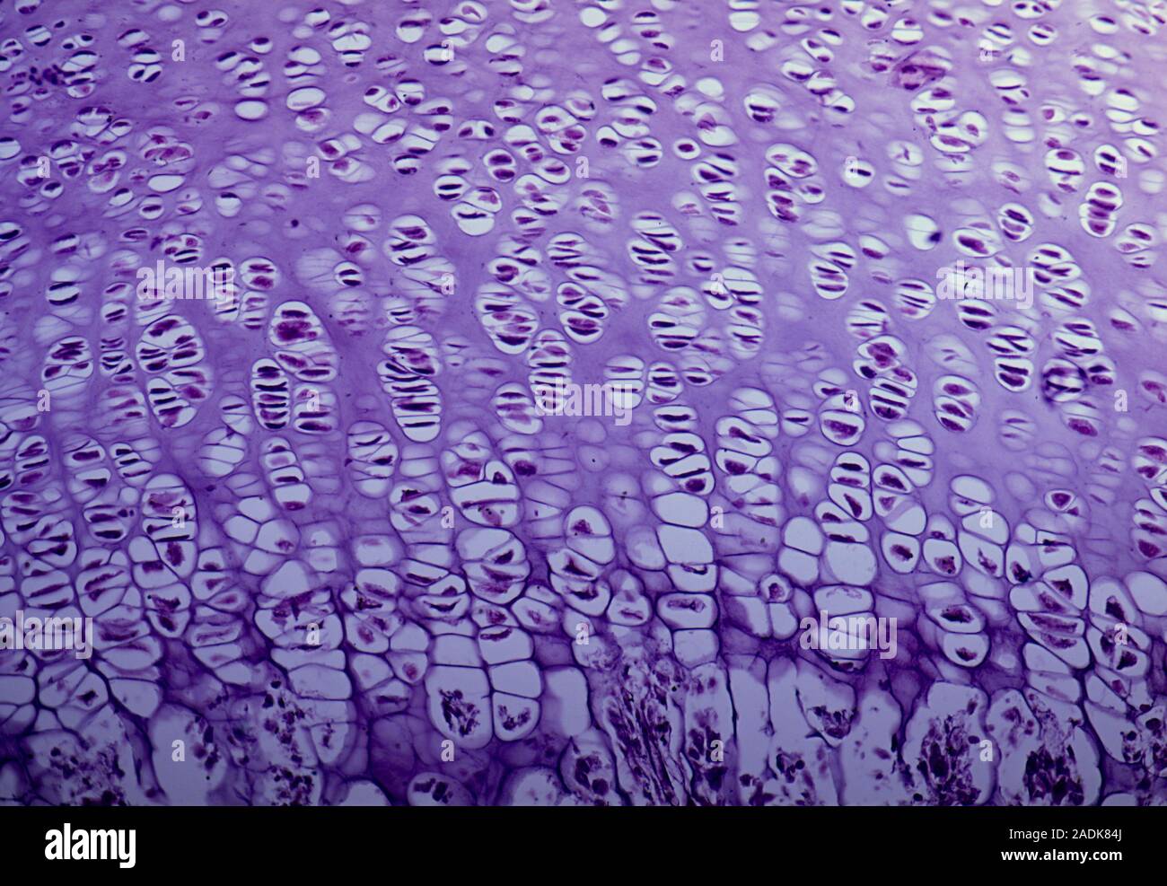 Bone Formation Light Micrograph Of A Longitudinal Section Through An Epiphyseal Growth Plate In