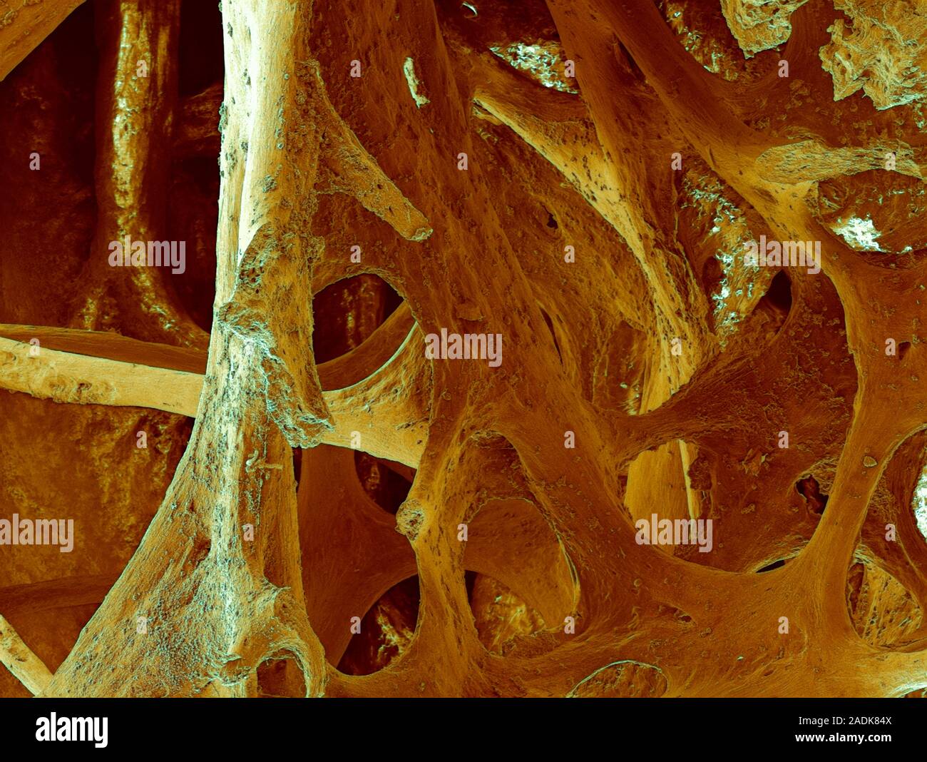 Bird bone. Coloured scanning electron micrograph (SEM) of the interior ...
