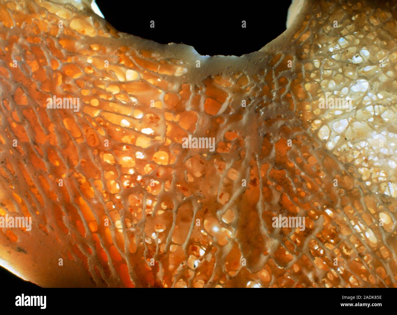 Macrophotograph showing cross-section of human hip bone (innominate ...