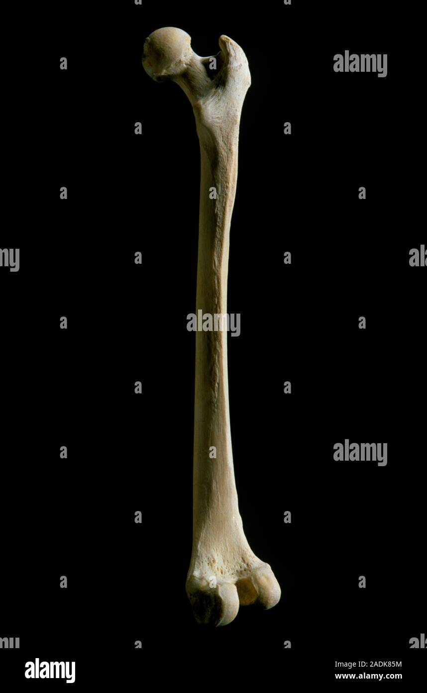 Human femur or thigh bone. This is the long bone between the hip & the ...